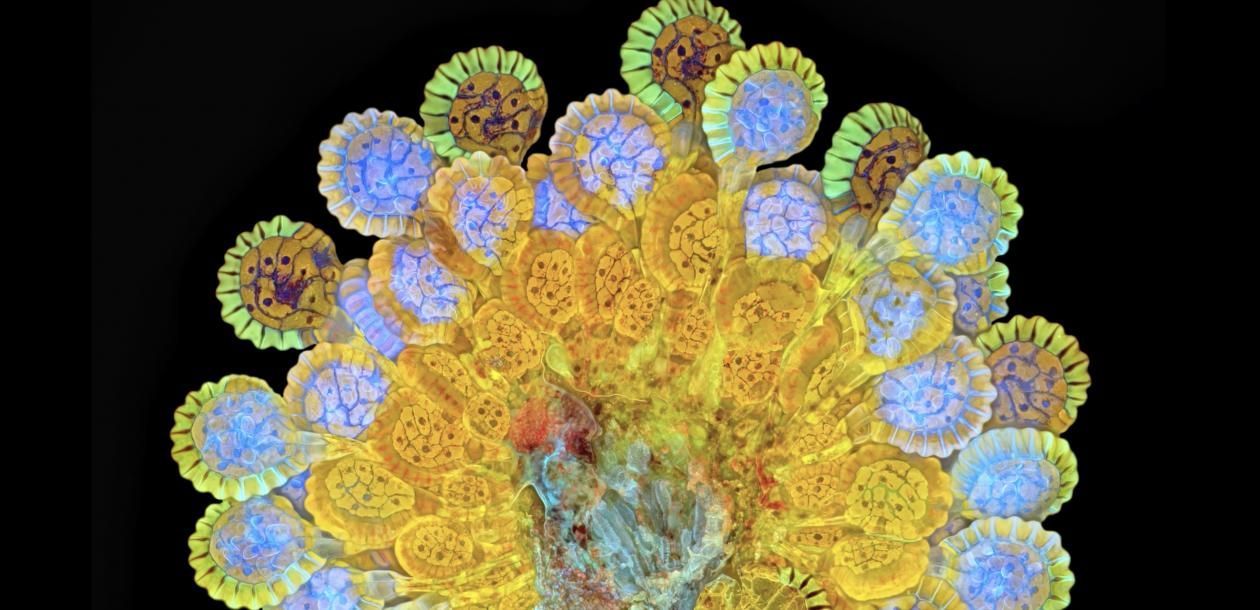 Micro Photo | Le blob, l'extra-média