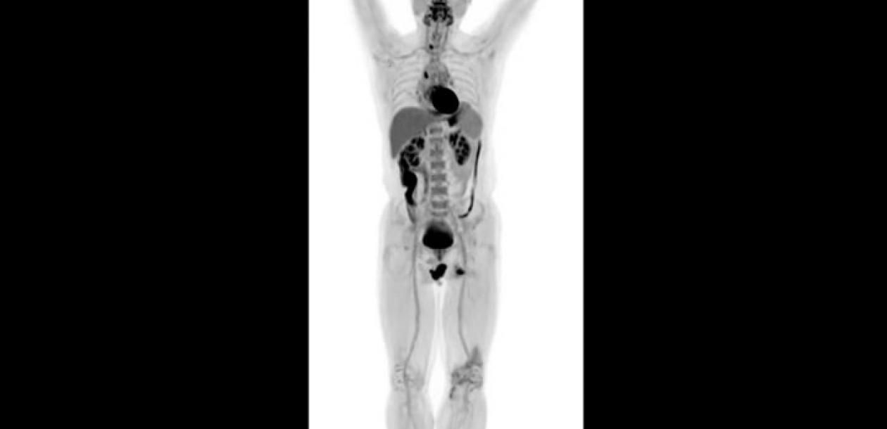 Scanner 3D : une exploration inédite du corps humain | Le blob, l'extra ...