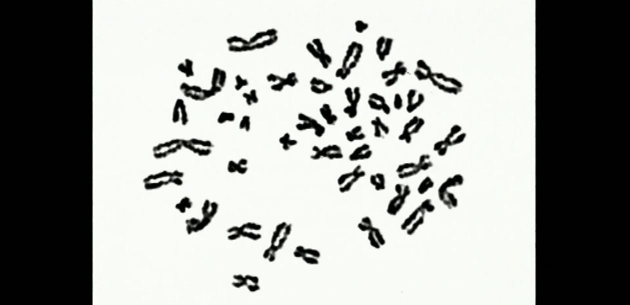 Microscope optique / 1er caryotype | Le blob, l'extra-média