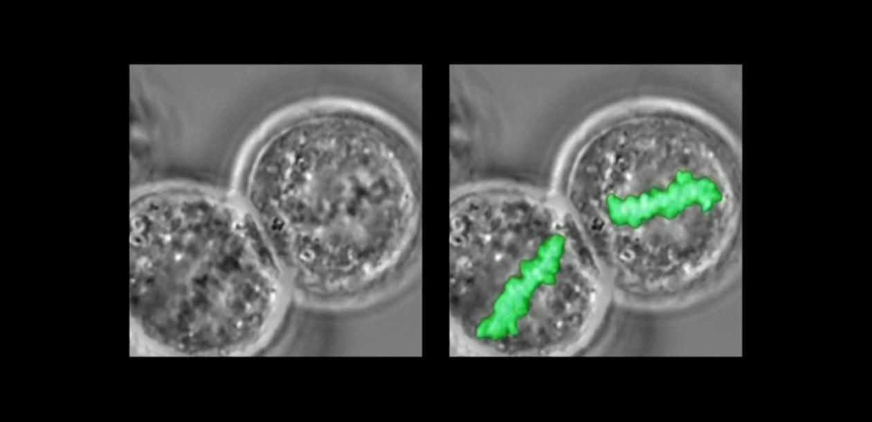 Microscope optique / Cellule en division | Le blob, l'extra-média
