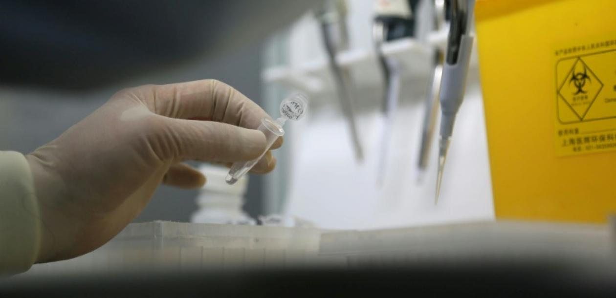 Un nouveau virus identifié en Chine après une pneumonie | Le blob, l ...
