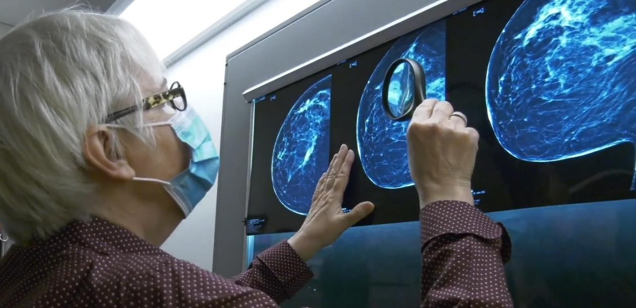 Cancer, la recherche progresse | Le blob, l'extra-média