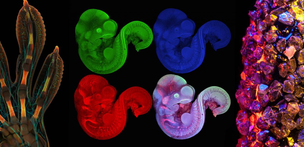 Les plus incroyables microphotos de l’année | Le blob, l'extra-média